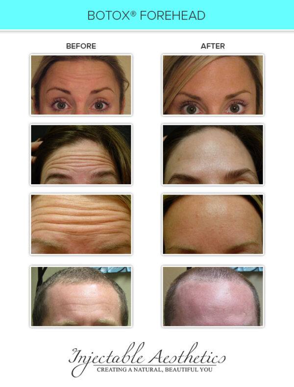 Treatments - Injectable Aesthetics