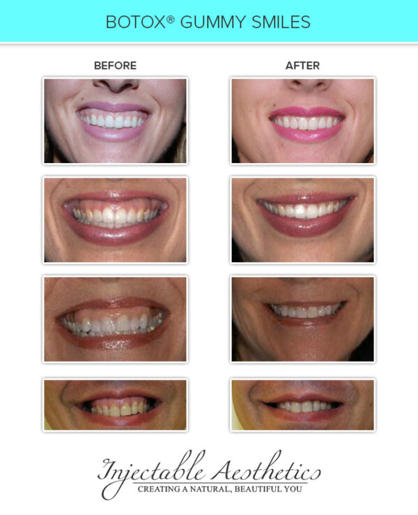 Treatments - Injectable Aesthetics