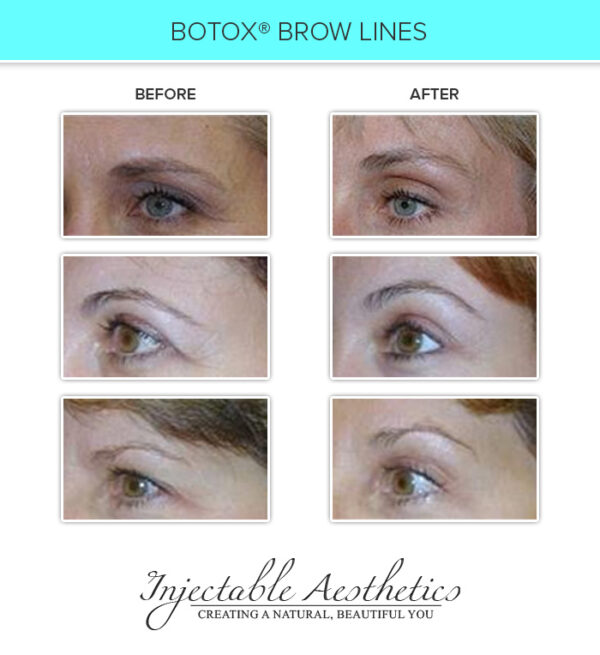 Treatments - Injectable Aesthetics