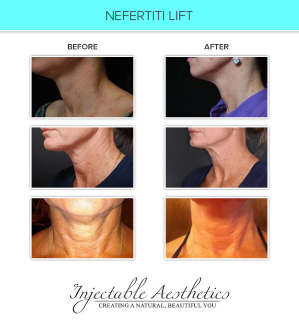 Treatments - Injectable Aesthetics