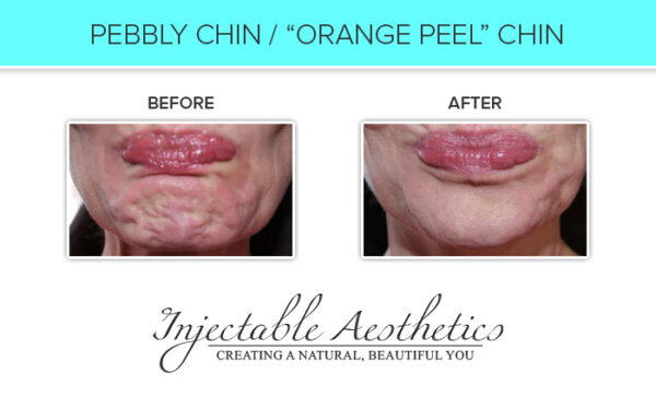 Treatments - Injectable Aesthetics
