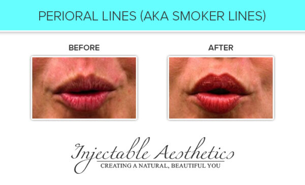 Treatments - Injectable Aesthetics