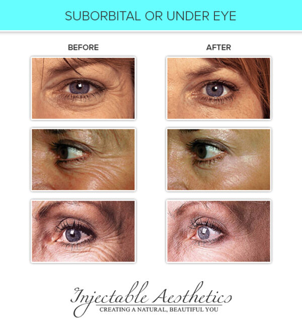 Treatments - Injectable Aesthetics
